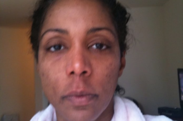 FORMER QVC TOP MODEL BATTLES TOXIC INJURY | Indiegogo