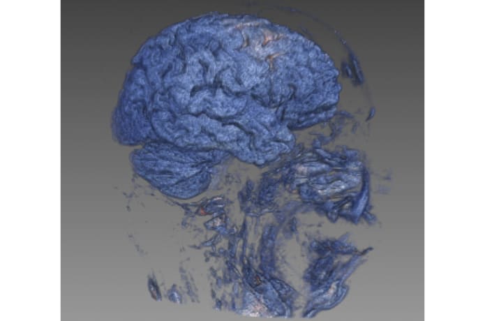 3D Medical Imaging Viewer for Accurate Diagnoses | Indiegogo