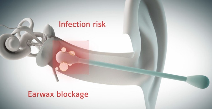 Ears 360 Last Reusable Ear cleaner | Indiegogo